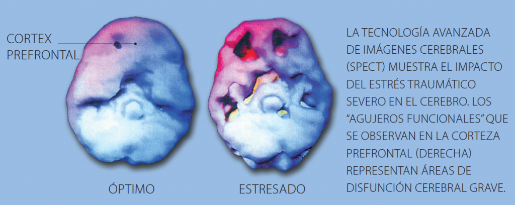 Brain-Based Approach to Peace: Stress Impairs Brain Functioning SPA – GUSP